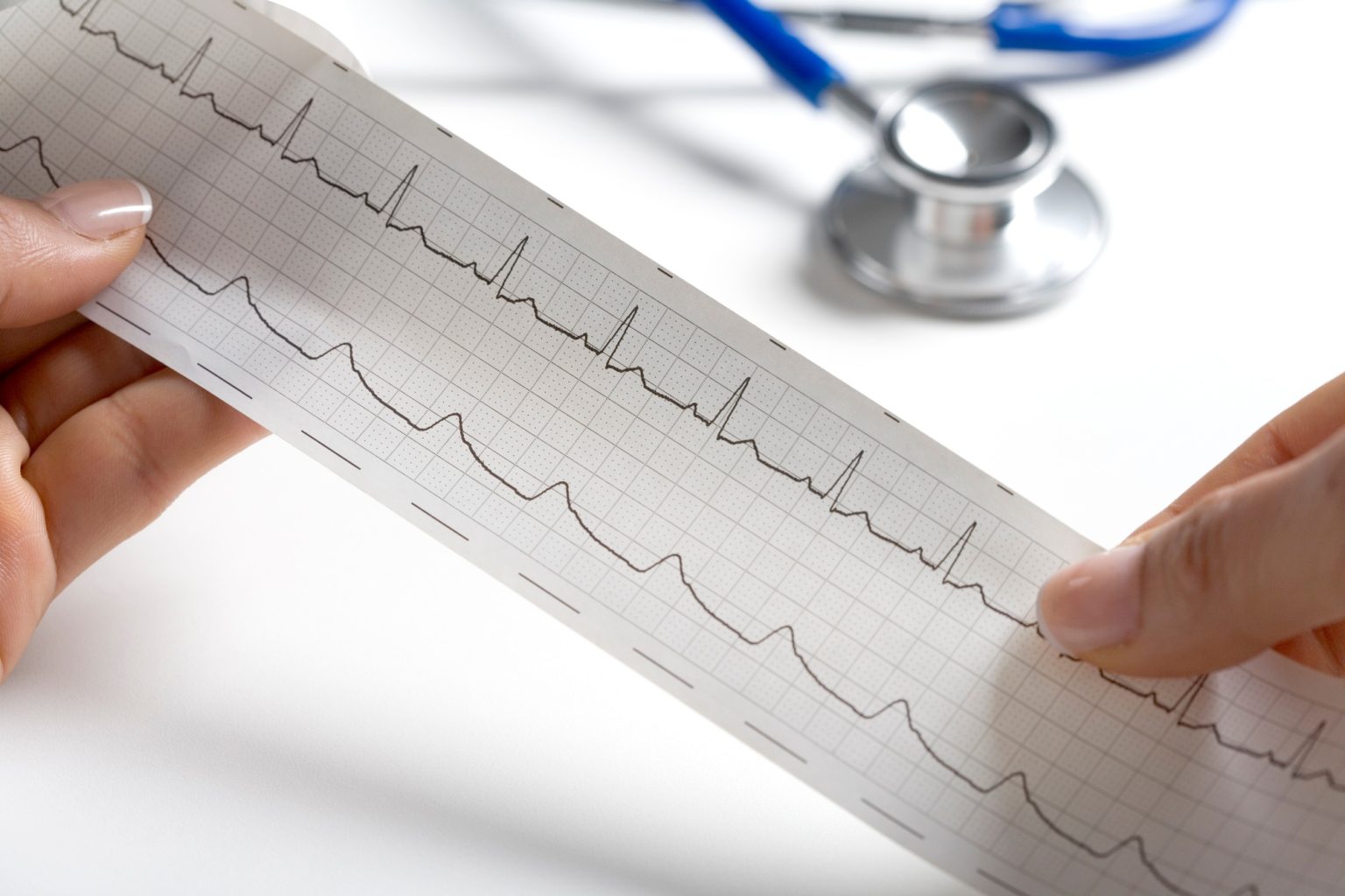 Britain’s Largest ECG Interpretation Service for NHS Primary Care